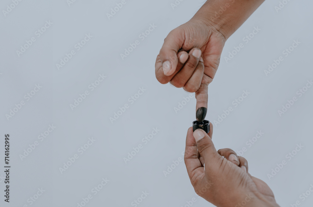 Inked pinky finger. Purple ink blots from voter's finger provides ...