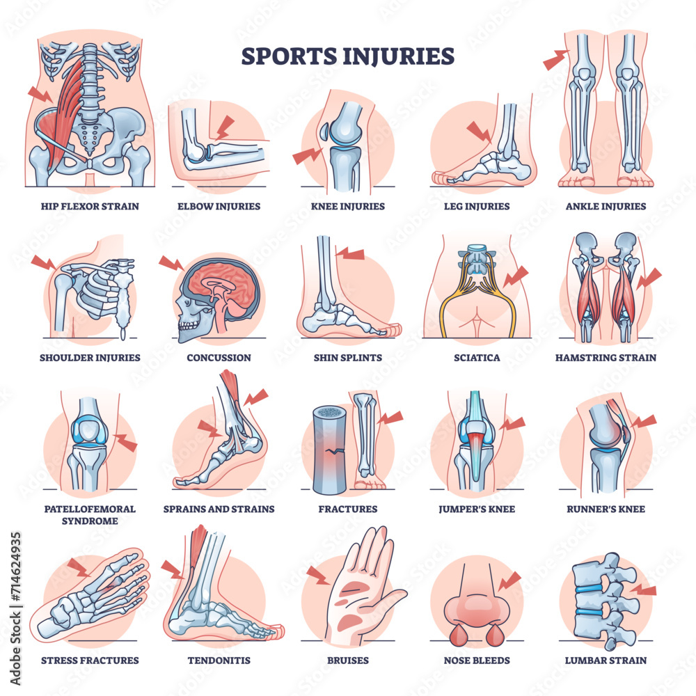 Sport injuries and most common athlete traumas outline collection set ...
