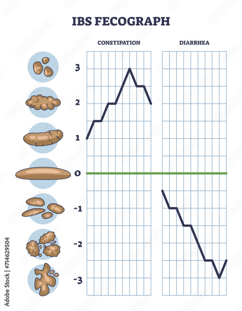 IBS fecograph as daily bristol stool form representation outline ...