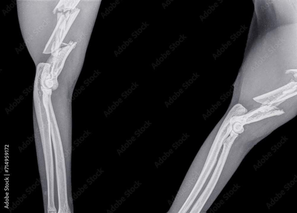 Digital front and side view X ray of the foreleg of a cat with a ...