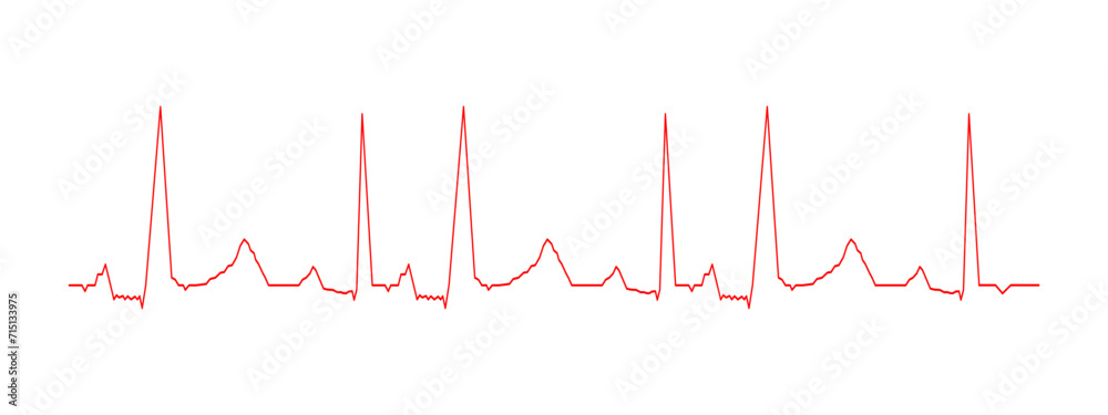 Heartbeat diagram. ECG chart. Cardiac rhythm red line. Cardio test sign ...