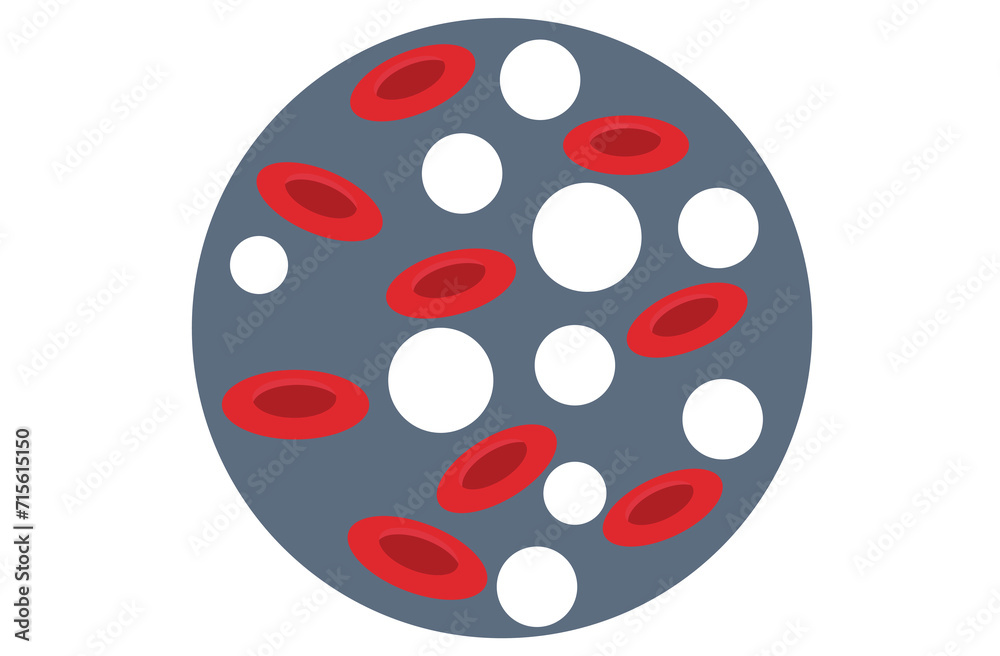 leukemia. Blood cancer. Red and white blood cells. Isolated vector ...