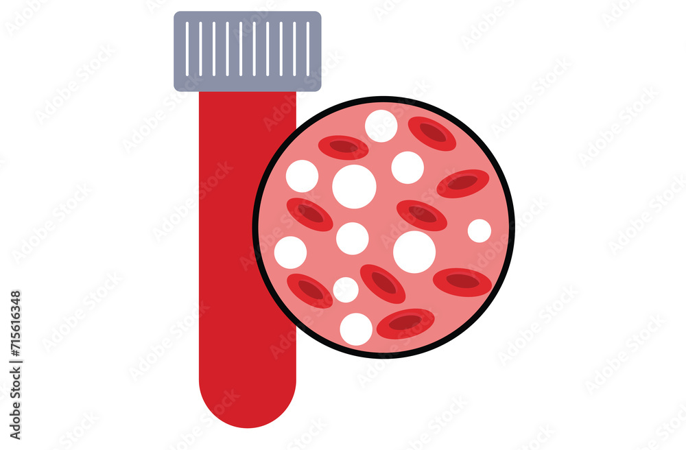leukemia. Blood cancer. Red and white blood cells. Isolated vector ...
