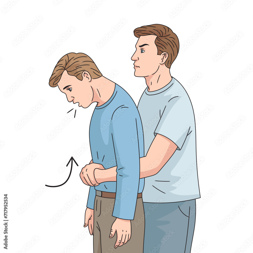 Poster Abdominal thrusts first-aid procedure Heimlich maneuver diagram ...