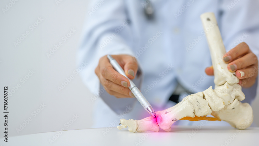 A therapist or orthopedic surgeon shows a toe bone model during a ...