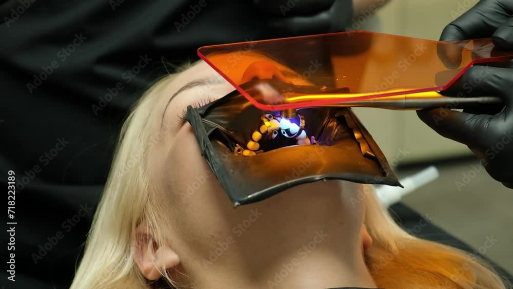 Restoration teeth, Therapy room, During teeth restoration and treatment ...