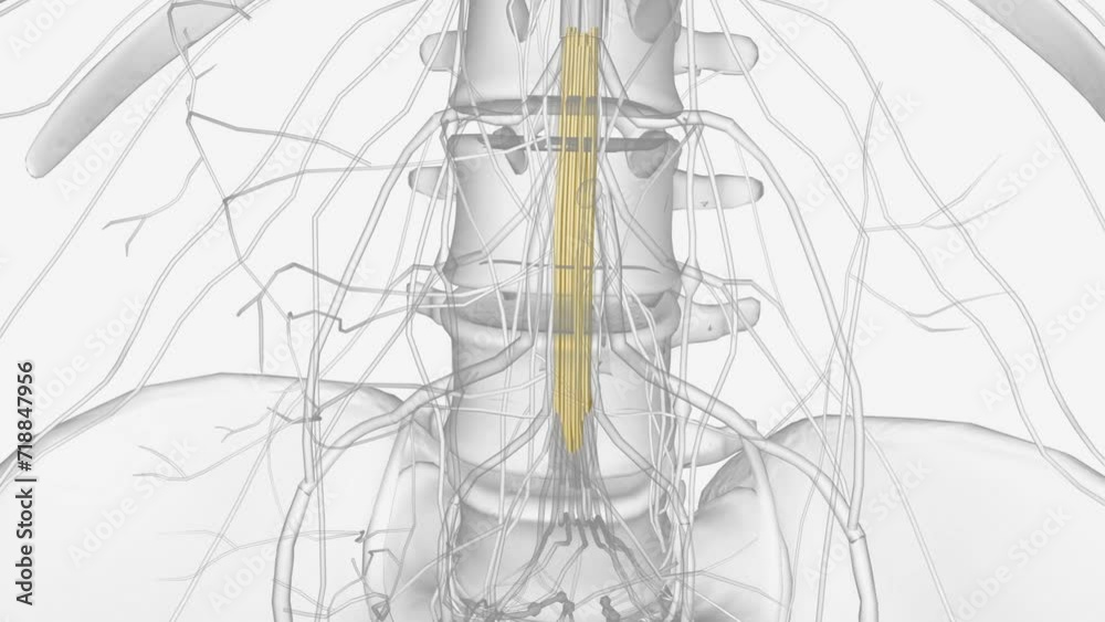 Vidéo Stock Cauda equina syndrome occurs when the nerve roots in the ...
