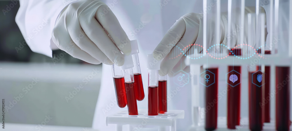 Doctor's test tubes with blood samples. Lab workers prepare test blood ...