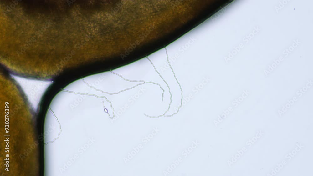 Vidéo Stock rare footage of sea anemone shooting urticating nematocysts ...