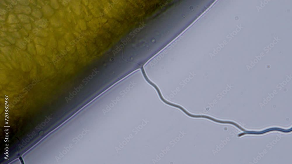 rare footage of sea anemone shooting urticating nematocysts and ...