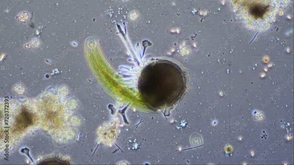 A testate amoeba, Diffulgia coronata, under the microscope at 200x ...