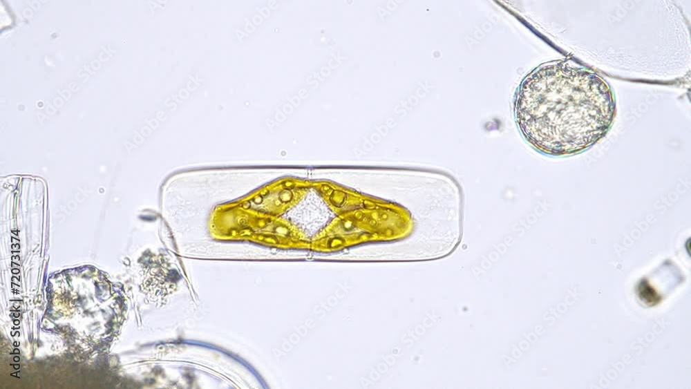 Diatom from the sea of Japan, seen under the microscope at 400x ...