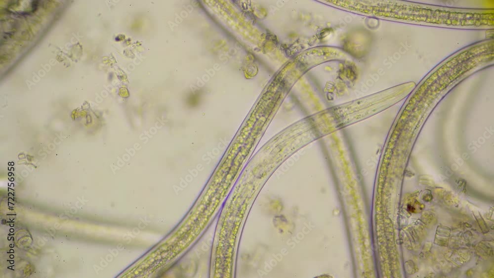 Strong moving roundworms, nematodes, under microscope at 400 times ...