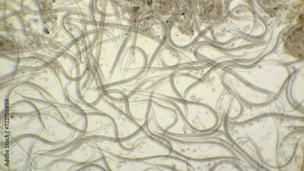 A microscopic view of roundworms nematodes, Steinernema, at 100 times ...