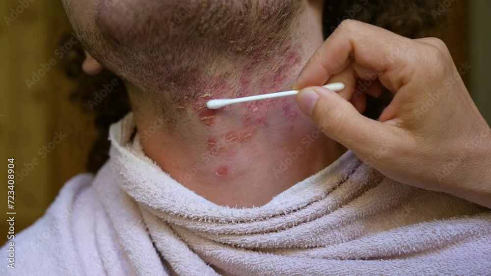 Footage with a close-up image of the face of a young Caucasian man ...