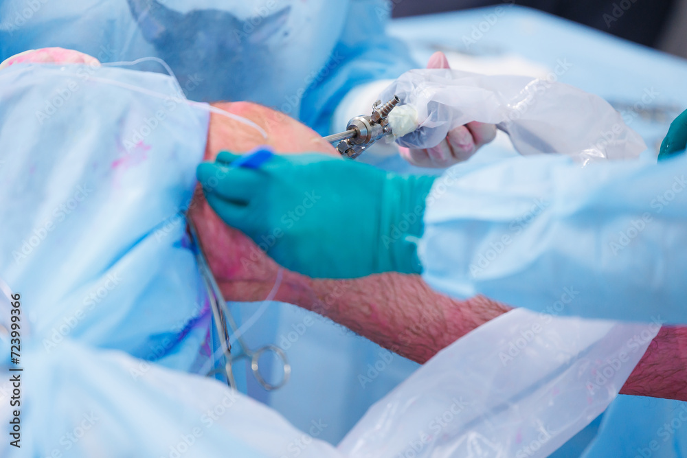 Minimally invasive surgery, suturing tendons and ligaments in knee of ...