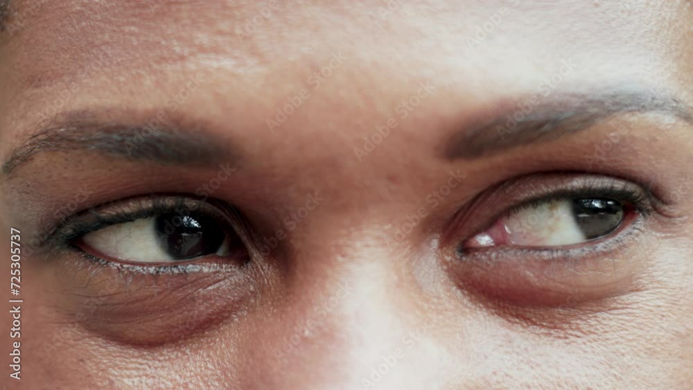 Macro of black woman brown eyes with freckles around looking at camera ...