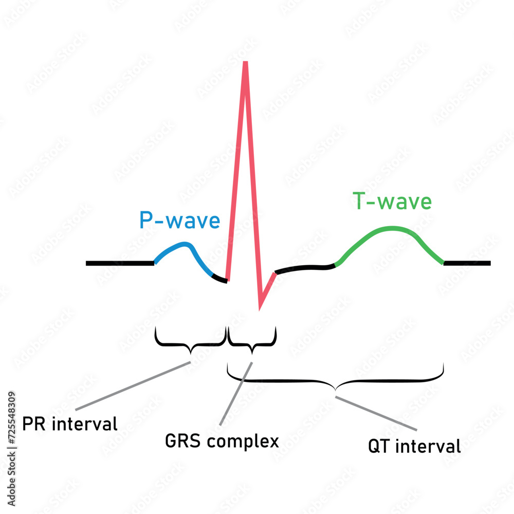 Ventricular repolarization, T wave. The QT interval of ECG. The cardiac ...