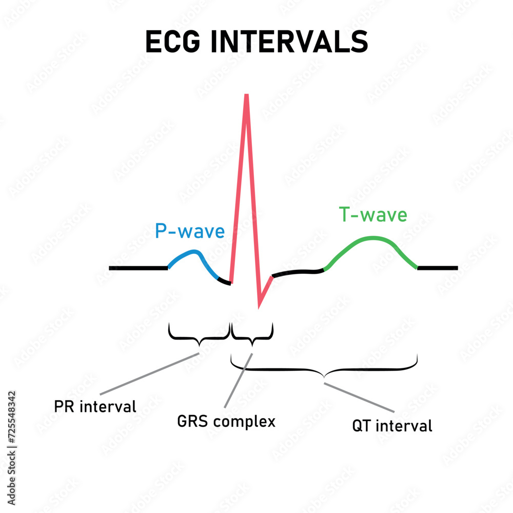 Ventricular repolarization, T wave. The QT interval of ECG. The cardiac ...
