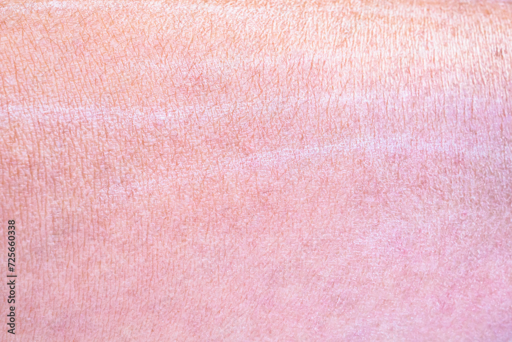 dry and dehydrated human skin texture background Stock Photo | Adobe Stock