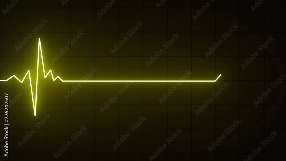 Glowing yellow neon Heart pulse monitor with signal. Electrocardiogram ...