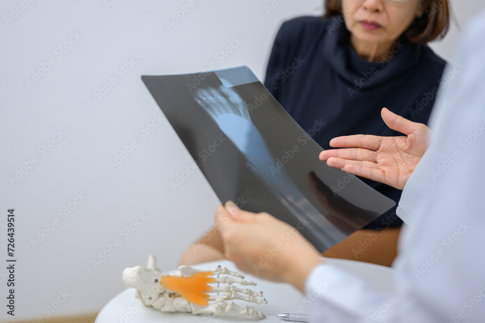 An orthopedic doctor holding an x-ray sheet of ankle and foot bones is ...