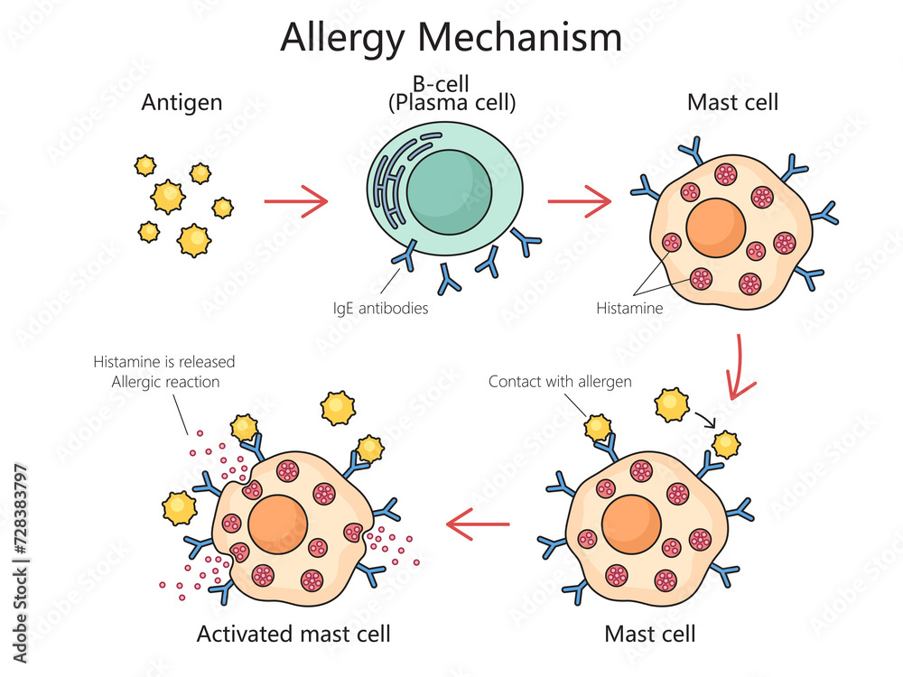 Mechanism of allergy action diagram hand drawn schematic raster illustration. Medical science ...