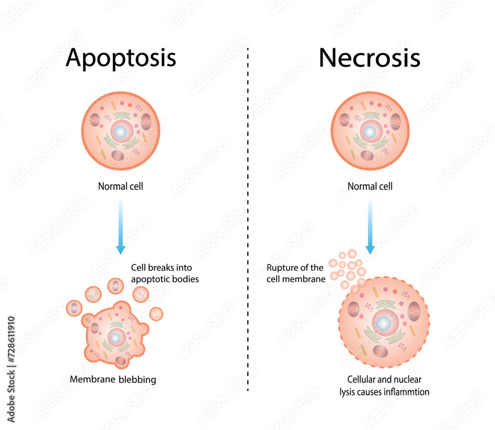 Necrosis and apoptosis of normal cell. cell death labeled outline ...