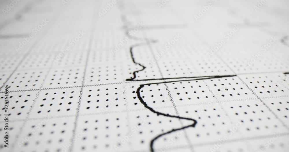 Printout of an ECG or EKG graph showing patient heart rate and ...