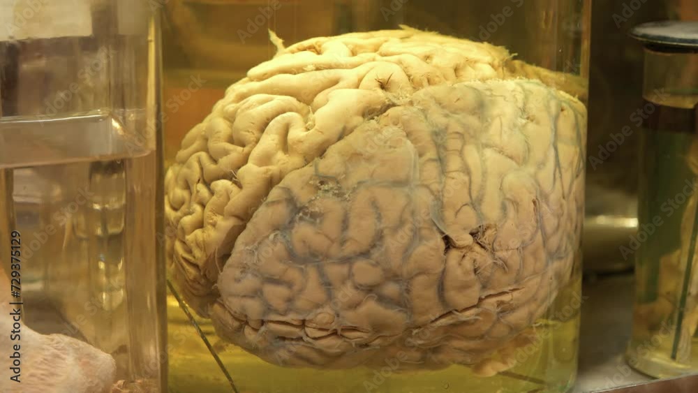 Real human brain. Anatomy of the brain. Human brain in glass jar with ...