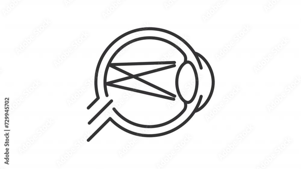 Astigmatism line animation. Eye disease animated icon. Vision blur ...