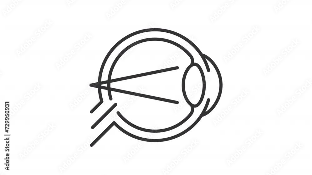 Vision diseases animation set. Perception disorders animated line icons ...