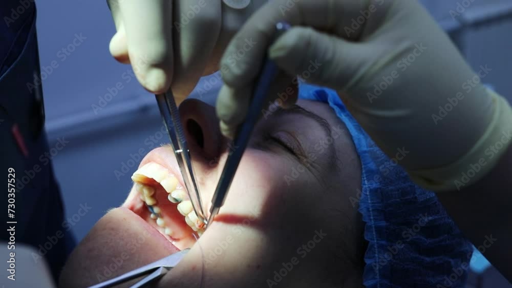 Face of patient, hands of dentist sutured wound after tooth extraction ...