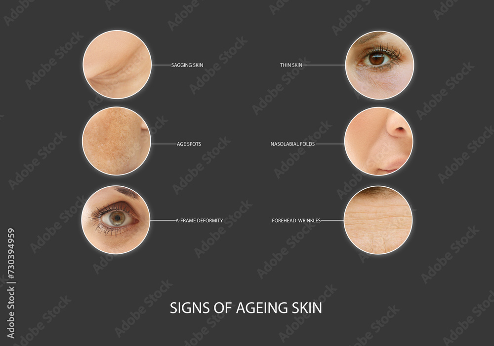 Signs of skin aging,signs of premature aging,.Wrinkles and fine lines ...