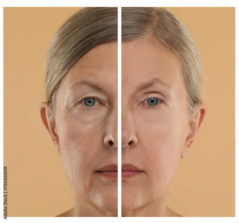 Poster Aging skin changes – Wall Art | UkPosters