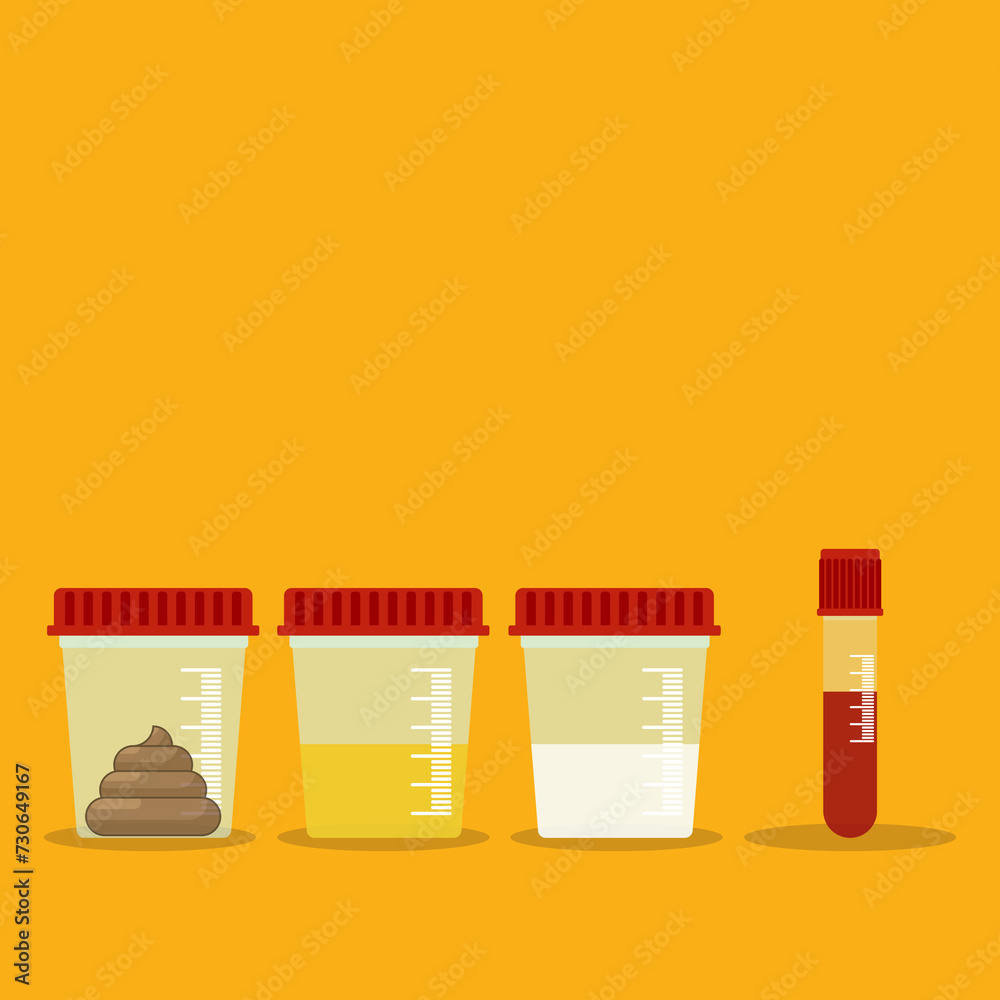 Urine, stool, sperm and blood analysis. Urine, stool, sperm and blood ...