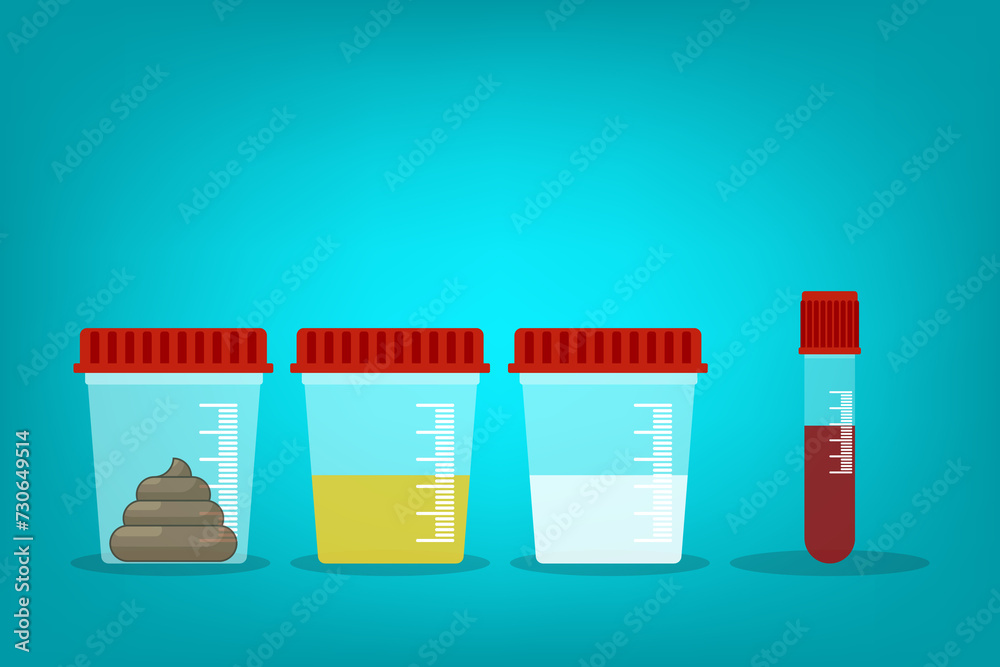 Urine, stool, sperm and blood analysis. Urine, stool, sperm and blood ...