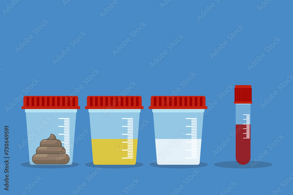 Urine, stool, sperm and blood analysis. Urine, stool, sperm and blood ...