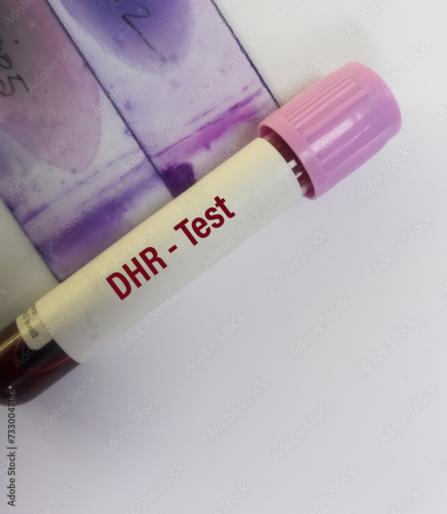Blood sample for DHR (Dihydrorhodamine) or Neutrophil Function Test for ...