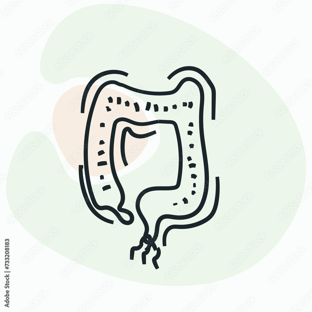 anal fissure is a small tear or cut in the lining of the anal canal ...