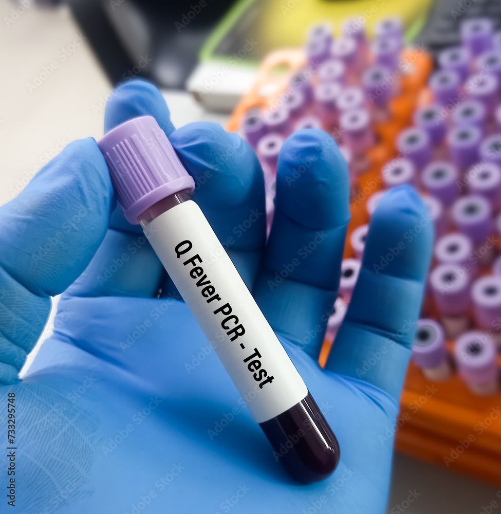 Blood sample for Q fever or query fever is a disease caused by ...