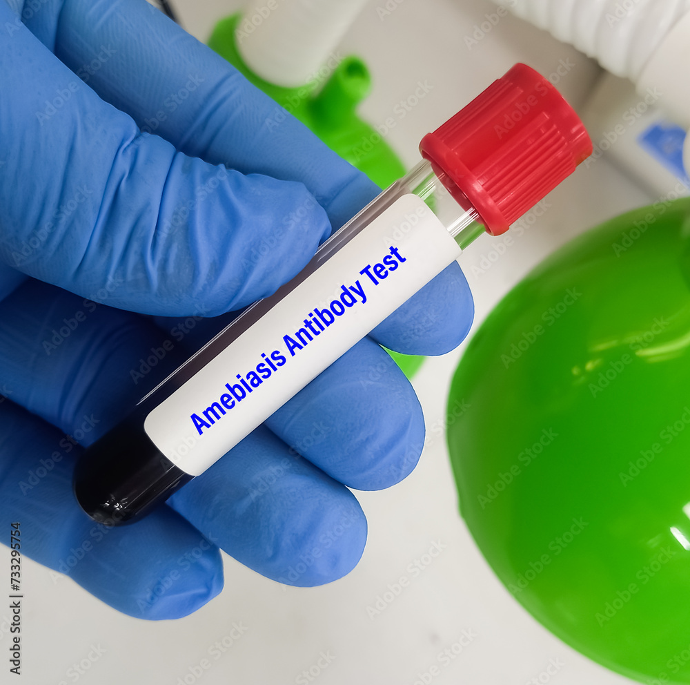 Bood sample for Entamoeba histolytica (E.histolytica) test, anaerobic ...
