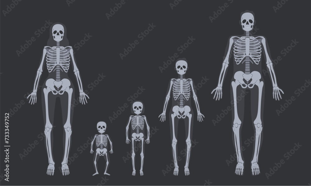 Family x-ray skeletons. Human skeletal systems from child to adult ...