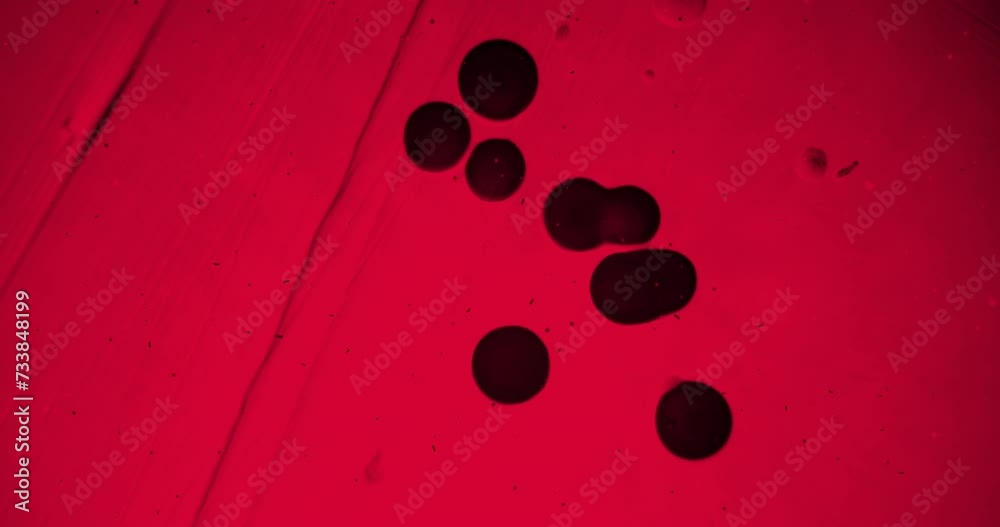 Thriller red bacteria and large dark spots under a microscope. Living ...