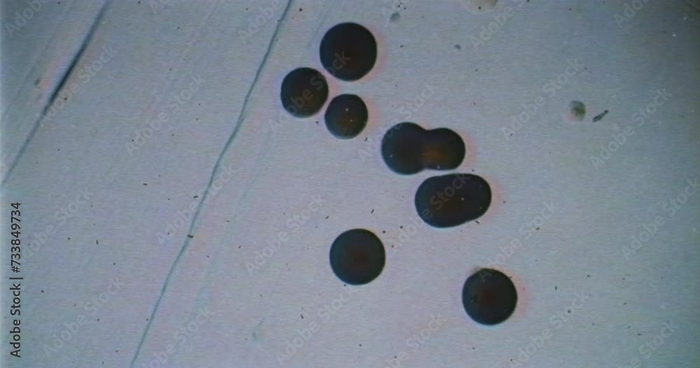 VHS recording of bacteria and large round dark spots under a microscope ...