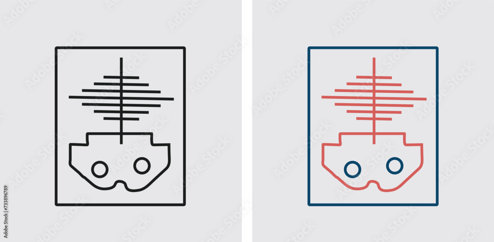 MRI uses magnetic fields and radio waves to produce detailed images of ...