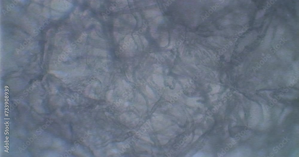 VHS recording of a spider web under a microscope. Floating bacteria and ...