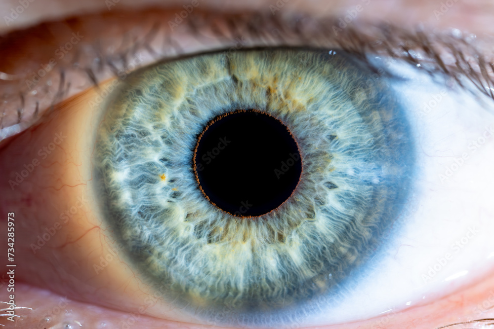 High Resolution male Green-Blue Colored Eye with Yellow Pigment Spots ...