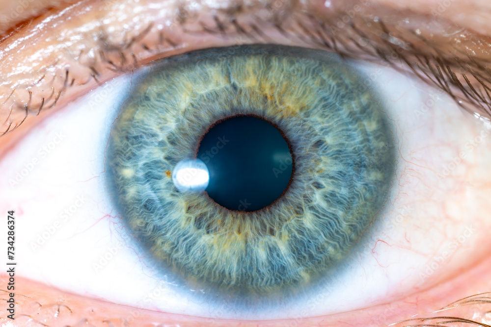 High Resolution male Green-Blue Colored Eye with Yellow Pigment Spots ...
