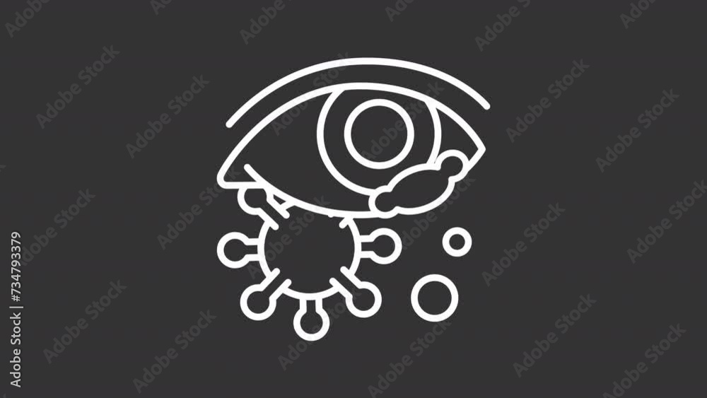 Eye infection white line animation. Conjunctivitis animated icon ...